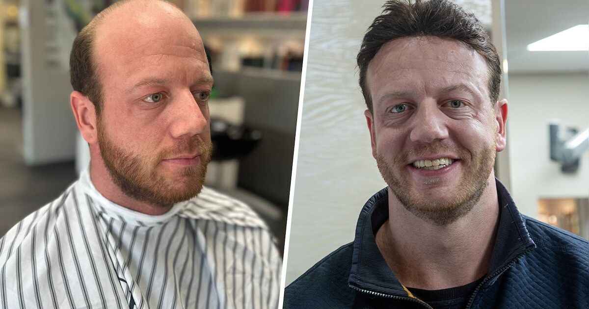 Nick is al op jonge leeftijd kaal, maar dan heeft zijn kapper een idee ...