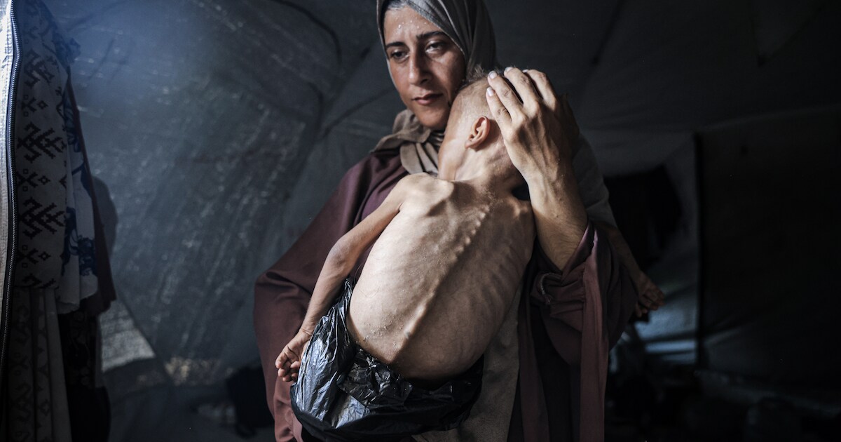 Ondervoed, of ligt het anders? Controver­se om schokkende foto uit Gaza ...