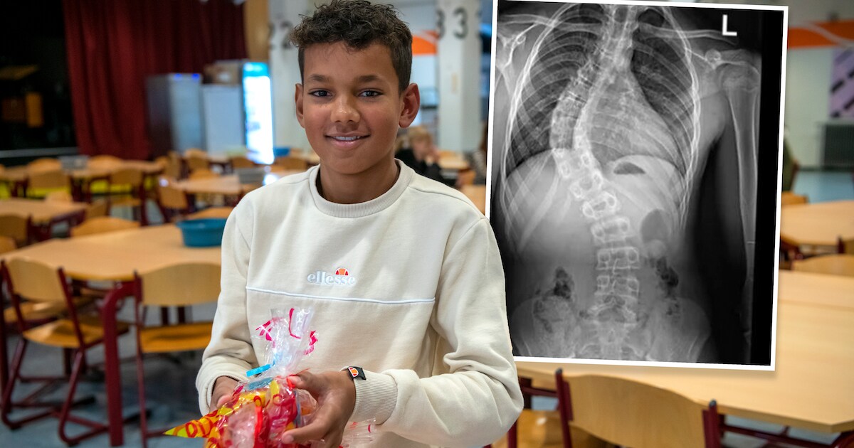 Kelshaw (13) verkoopt snoep omdat verzekering zijn operatie niet ...